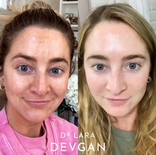 Top 10 Transformations – Dr. Lara Devgan Skincare